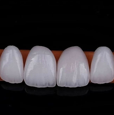 Crown and Bridge - Istar leading China dental lab outsourcing