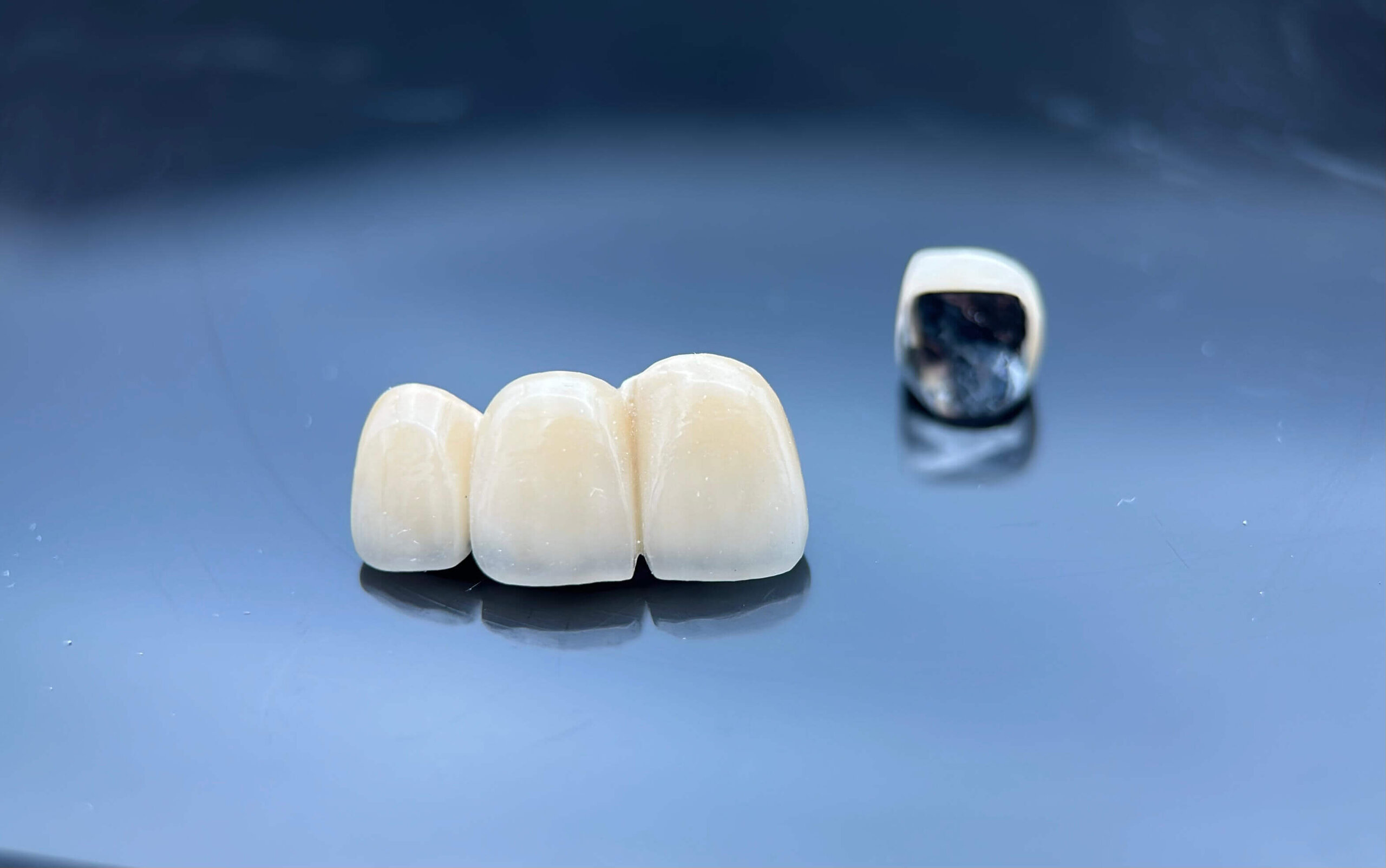 Crown and Bridge - Istar leading China dental lab outsourcing