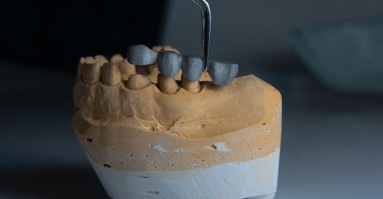 How Long Does It Take To Get a Crown Back from The Lab?