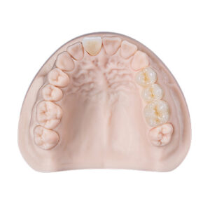 China Dental Laboratory | Full Service Dental Lab | Istar