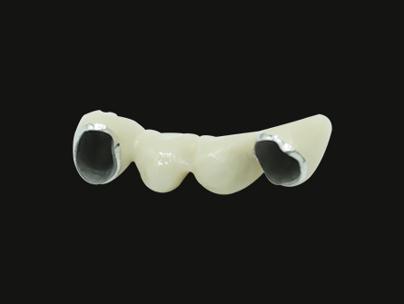 Istar: Your Trusted Crown & Bridge Dental Lab