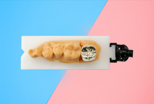 PFM Crown Metal Occlusal - Personal Istar Dental Laboratory