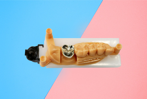 PFM Crown Metal Occlusal - Personal Istar Dental Laboratory