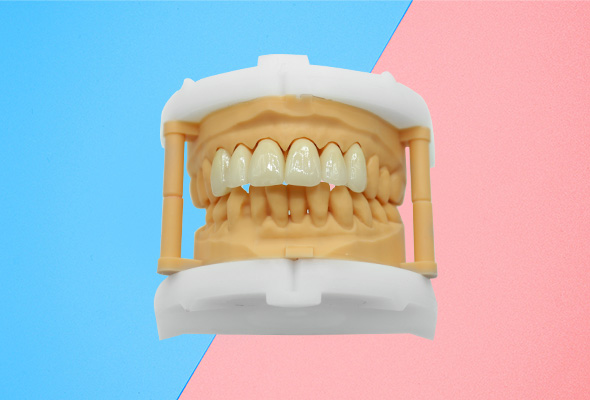Layered Zirconia Crown & Bridge | Istar Dental Lab