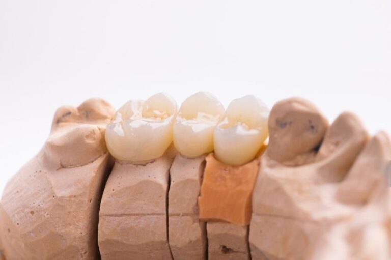 Premium Full Contour Zirconia Crown and Bridge | Istar