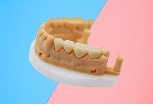Premium Full Contour Zirconia Crown and Bridge | Istar