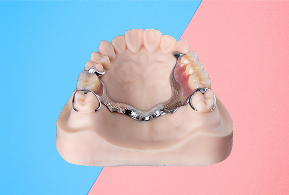 Vitallium Dentures | Precision Partial Frameworks by Istar