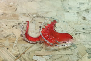 Hawley Orthodontic Retainers | Istar Dental Lab