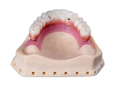 Restore Full Smiles with Istar Full Arch Dental Lab